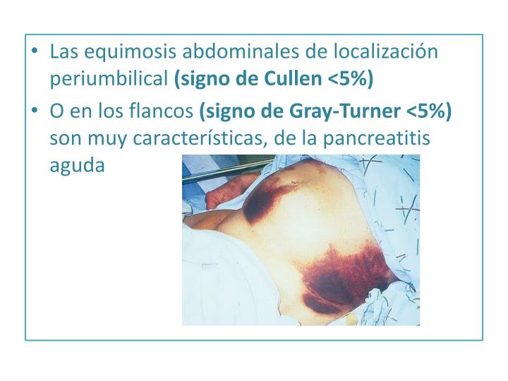 PPT - PANCREATITIS AGUDA PowerPoint Presentation - ID:1150562