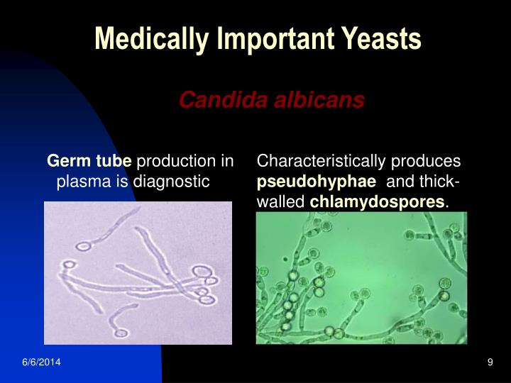 PPT - Eukaryotic Microbes PowerPoint Presentation - ID:1151207