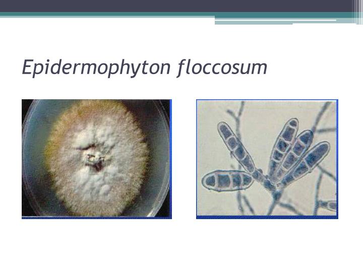PPT - UNIVERSIDAD VERACRUZANA FAC. DE BIOANALISIS XALAPA EE. MICOLOGIA ...