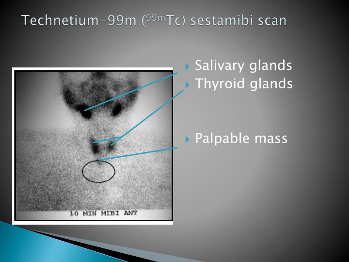PPT - ENDOCRINE SURGERY PowerPoint Presentation - ID:1152656
