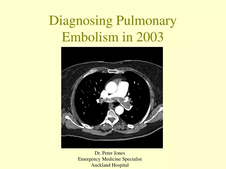 PPT - Diagnosing Pulmonary Embolism in 2003 PowerPoint Presentation ...