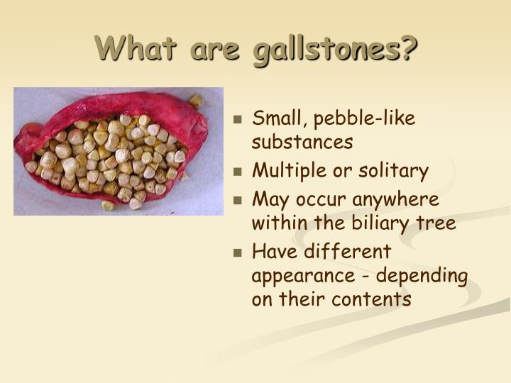 PPT - GALLSTONES PowerPoint Presentation - ID:1158373