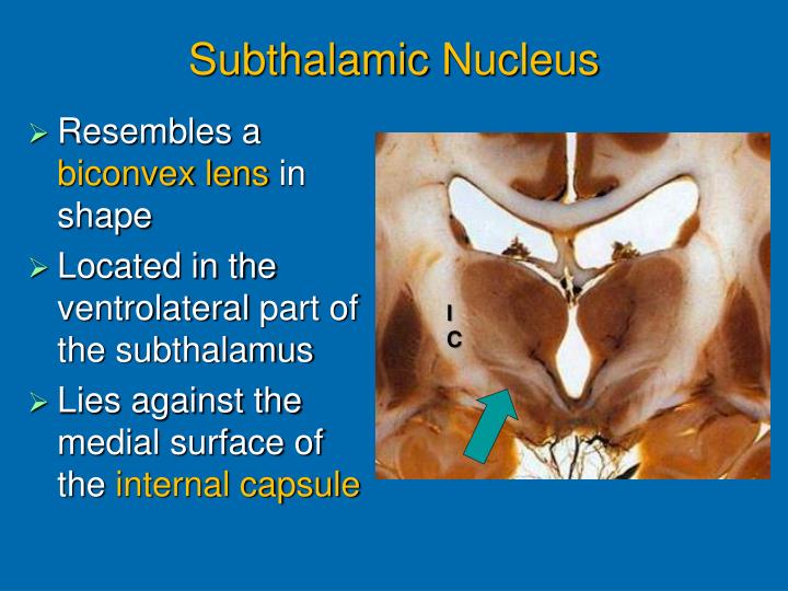 PPT - Subthalamus & Hypothalamus PowerPoint Presentation - ID:1159156