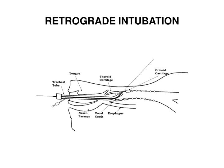 PPT - AIRWAY MANAGEMENT establishing, maintaining & removing artificial ...