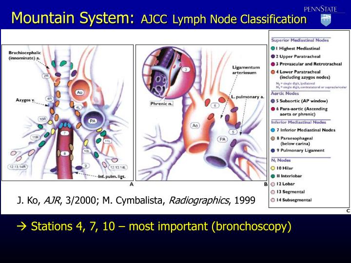 PPT - Extraction and Visualization of the Central Chest Lymph Node ...