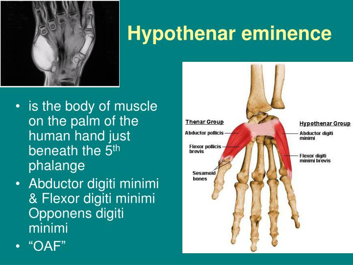PPT - Anatomy of the Hand and Wrist PowerPoint Presentation - ID:1170323