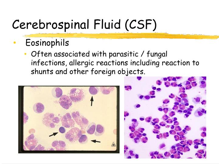 PPT - Urinalysis and Body Fluids CRg PowerPoint Presentation - ID:1172195