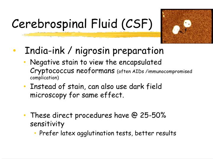 PPT - Urinalysis and Body Fluids CRg PowerPoint Presentation - ID:1172195