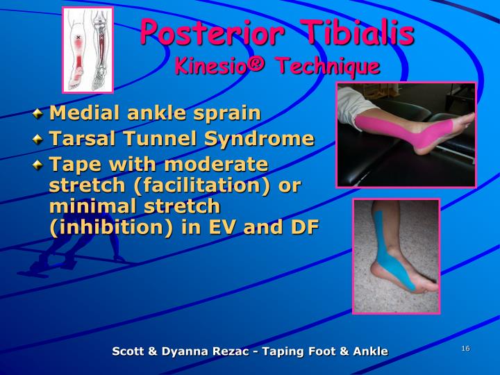PPT - Therapeutic Taping for the Foot and Ankle PowerPoint Presentation ...