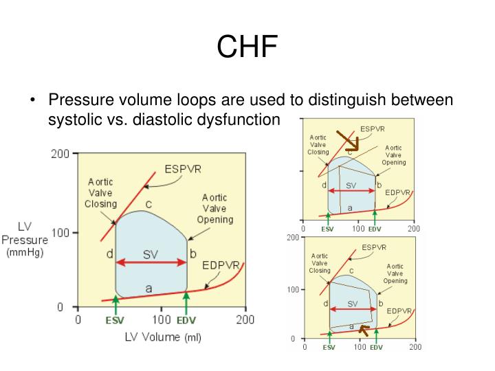 PPT - Pathophysiology of CHF PowerPoint Presentation - ID:1176241
