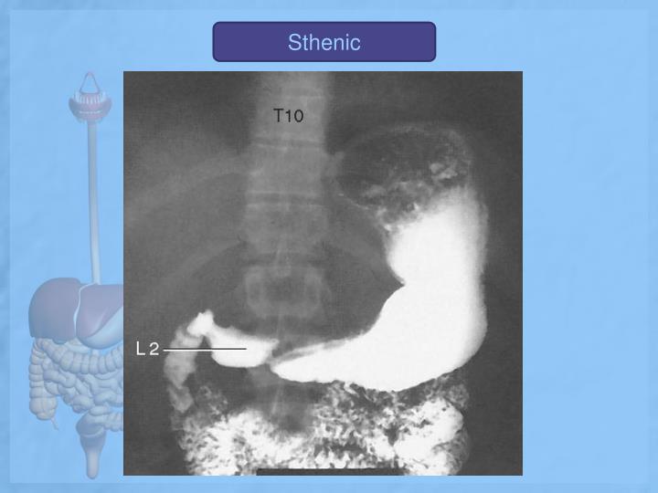PPT - Biliary Tract and Upper Gastrointestinal System II PowerPoint ...