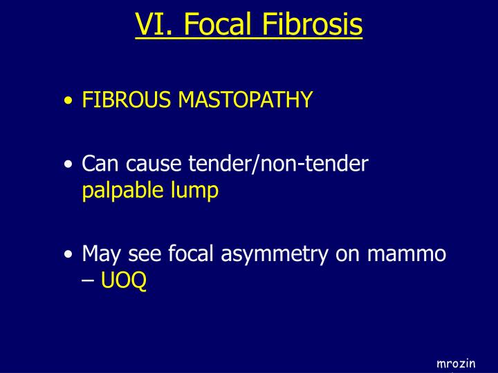 PPT - BENIGN MASSES IN BREAST ULTRASOUND PowerPoint Presentation - ID ...