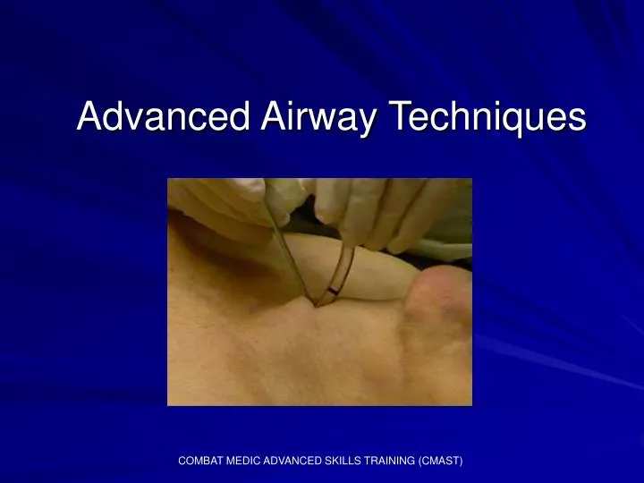 PPT - Advanced Airway Techniques PowerPoint Presentation, free download ...