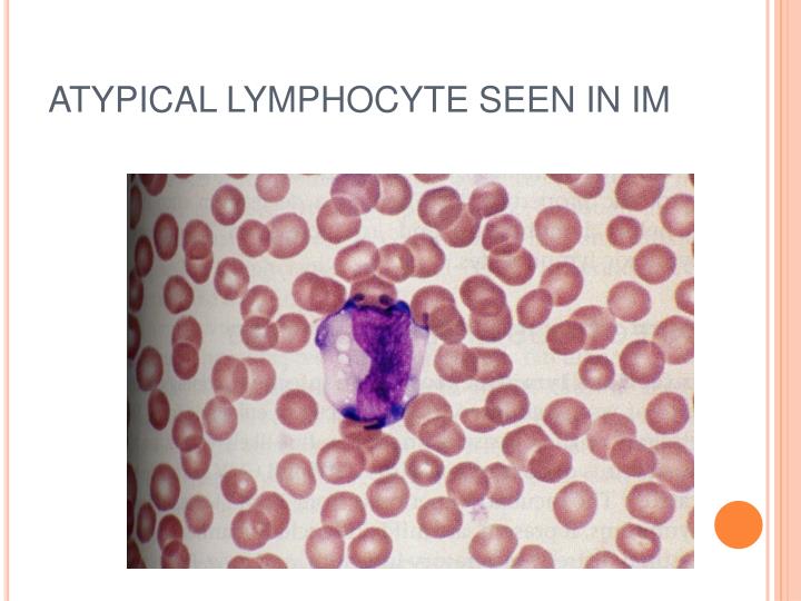 PPT - NONMALIGNANT LEUKOCYTE DISORDERS PowerPoint Presentation - ID:1195910