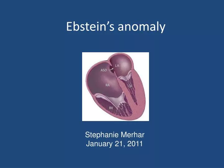 PPT - Ebstein’s anomaly PowerPoint Presentation, free download - ID:1196004