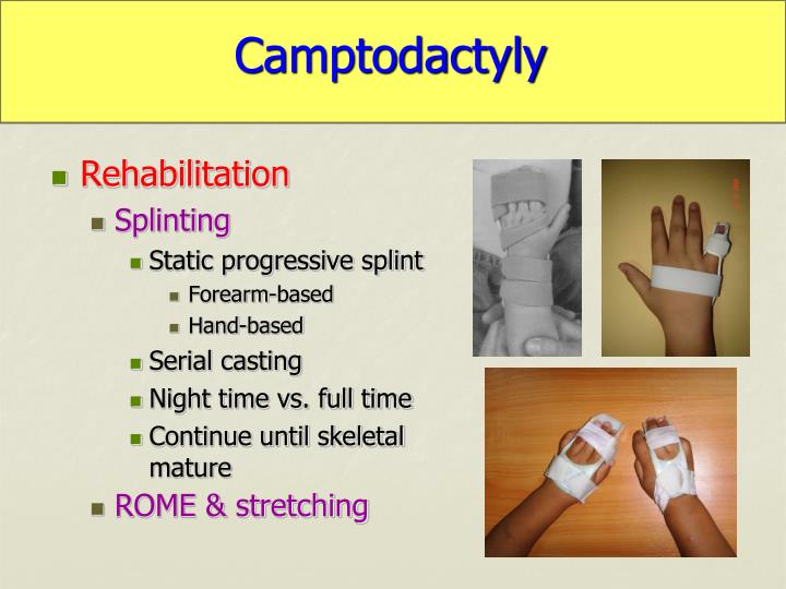 PPT - Rehabilitation of Congenital Limb Anomalies PowerPoint ...