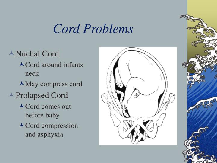 PPT - Neonatal Assessment PowerPoint Presentation - ID:1196886