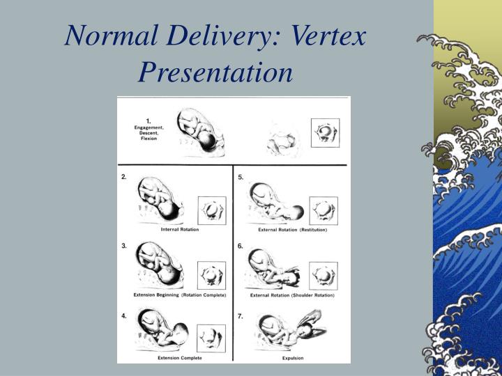 PPT - Neonatal Assessment PowerPoint Presentation - ID:1196886