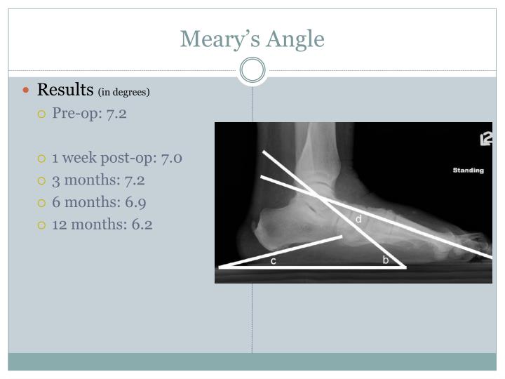 PPT - Amount of shortening following the Lapidus procedure (measure pre ...