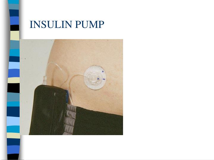 PPT - DIABETES MELLITUS PowerPoint Presentation - ID:1200790