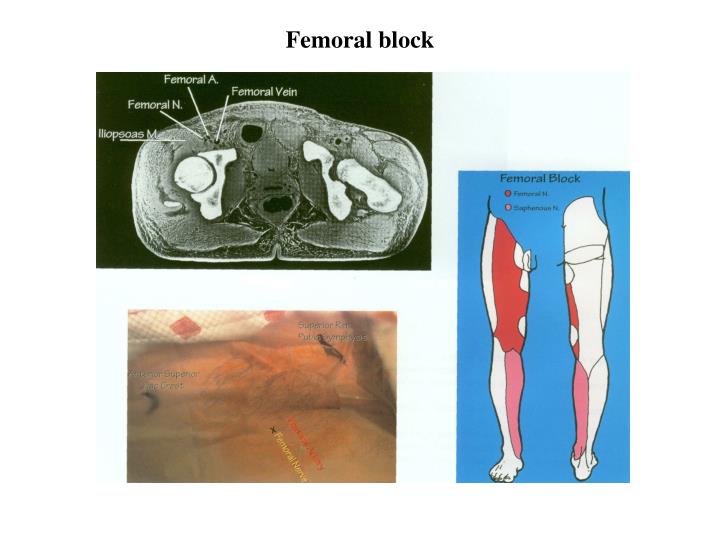 PPT - Lower Extremity Peripheral Nerve Blocks PowerPoint Presentation ...