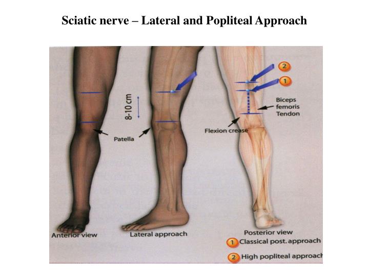 PPT - Lower Extremity Peripheral Nerve Blocks PowerPoint Presentation ...