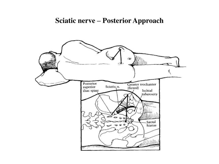 PPT - Lower Extremity Peripheral Nerve Blocks PowerPoint Presentation ...