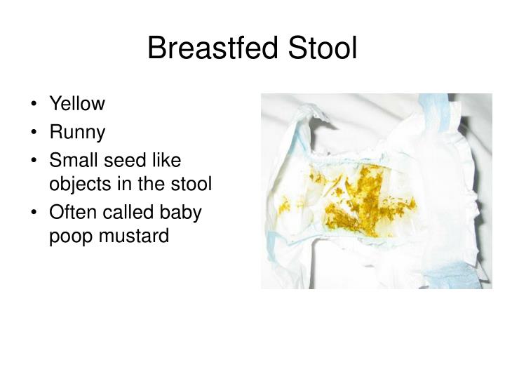 PPT - Meconium: A Sticky Situation PowerPoint Presentation - ID:1201418