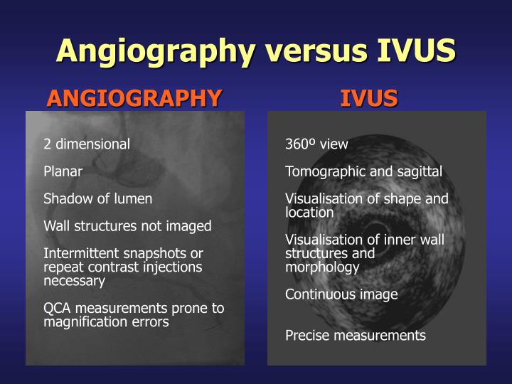 PPT - When I Use IVUS Neal Uren MD FRCP Consultant Cardiologist Royal ...