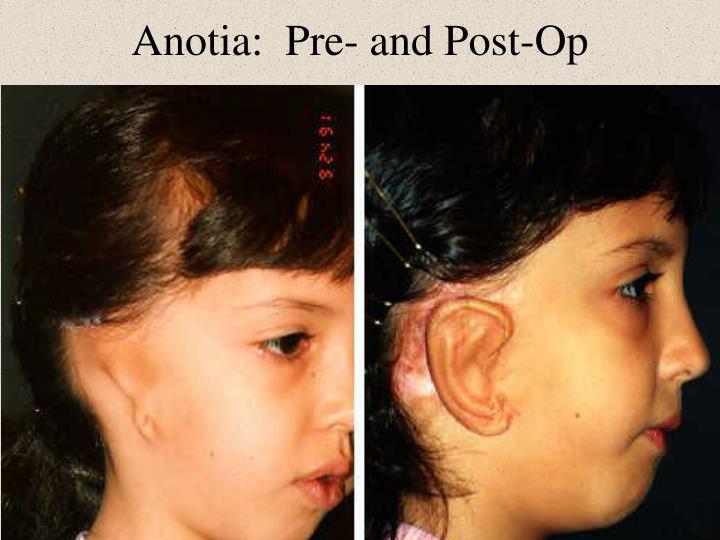 PPT - The Outer Ear PowerPoint Presentation - ID:1209173