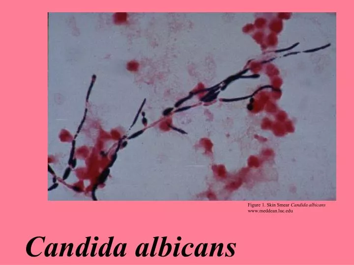 PPT - Candida albicans PowerPoint Presentation, free download - ID:1217242