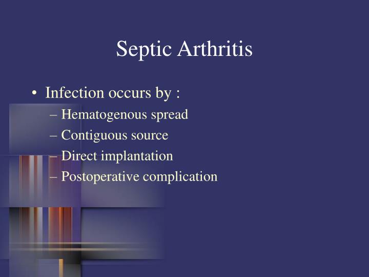 PPT - JOINTS PowerPoint Presentation - ID:1220675