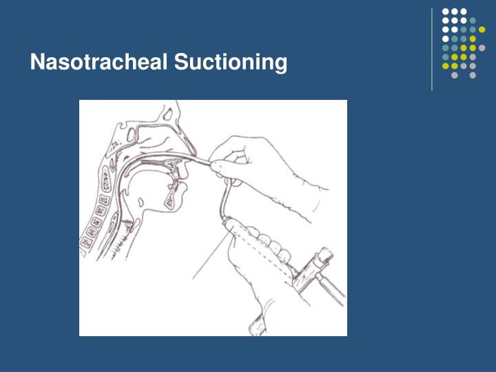 PPT - Airway Management Part II PowerPoint Presentation - ID:1221294