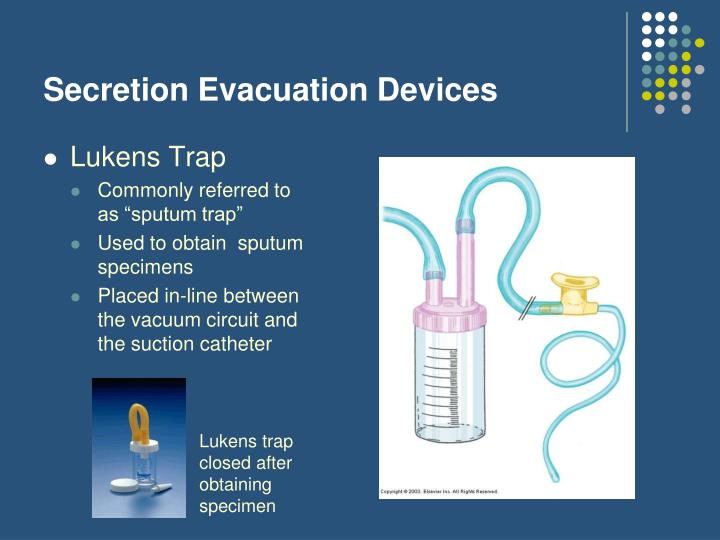 PPT - Airway Management Part II PowerPoint Presentation - ID:1221294