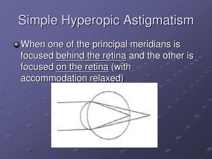 PPT - Astigmatism PowerPoint Presentation - ID:1223322