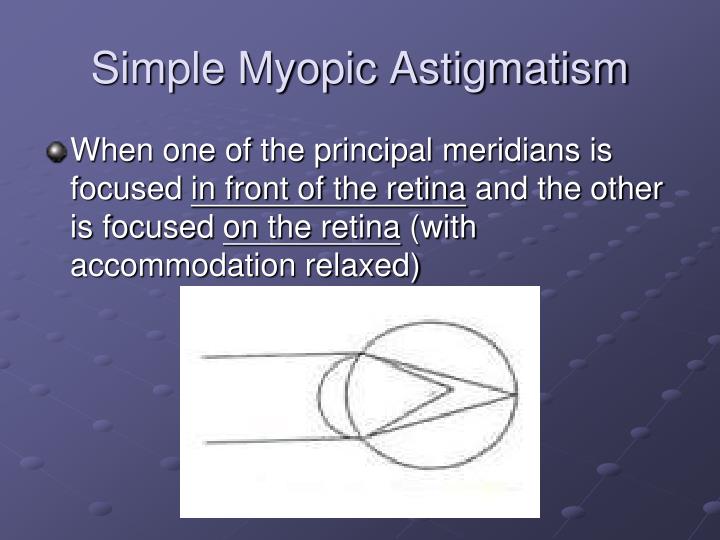 PPT - Astigmatism PowerPoint Presentation - ID:1223322