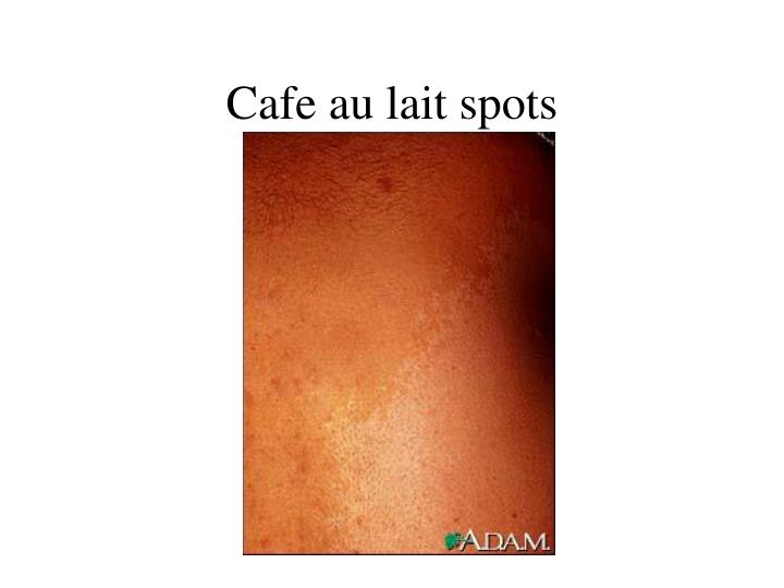 PPT - Dermatological disorders in children PowerPoint Presentation - ID ...