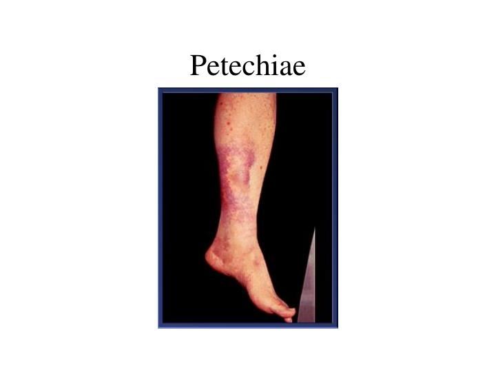 PPT - Dermatological disorders in children PowerPoint Presentation - ID ...