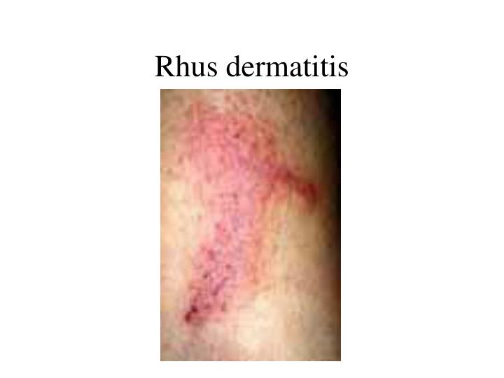 PPT - Dermatological disorders in children PowerPoint Presentation - ID ...