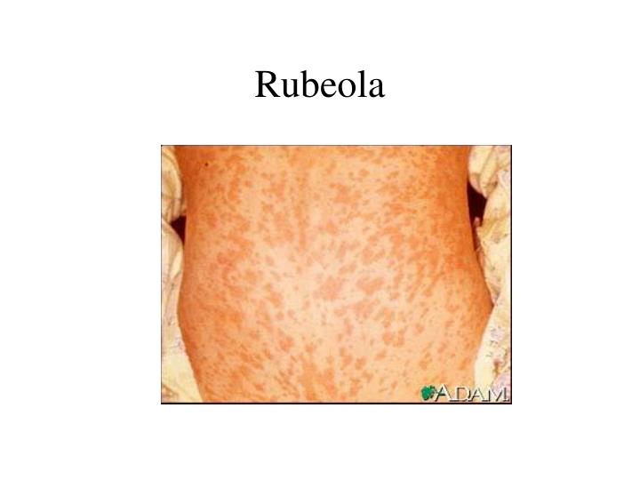 PPT - Dermatological disorders in children PowerPoint Presentation - ID ...