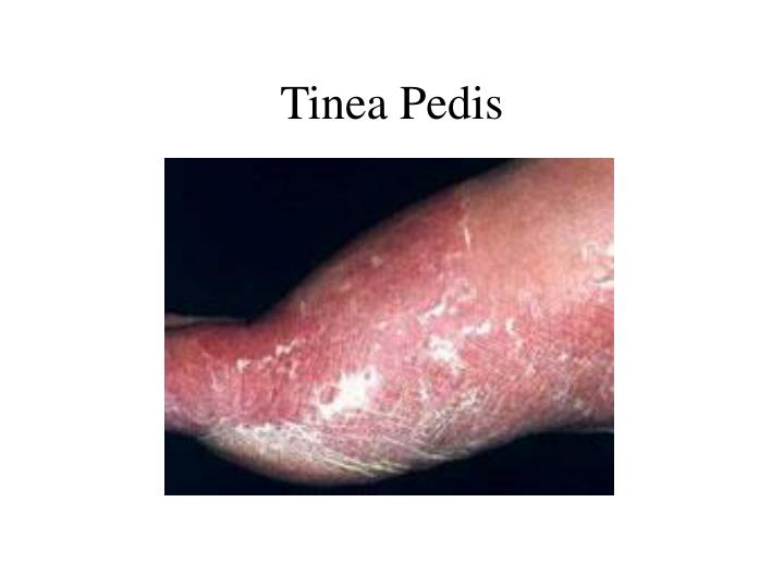 PPT - Dermatological disorders in children PowerPoint Presentation - ID ...
