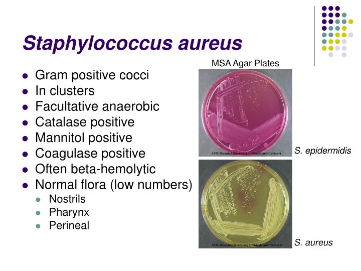 PPT - MICR 454L PowerPoint Presentation - ID:1226667