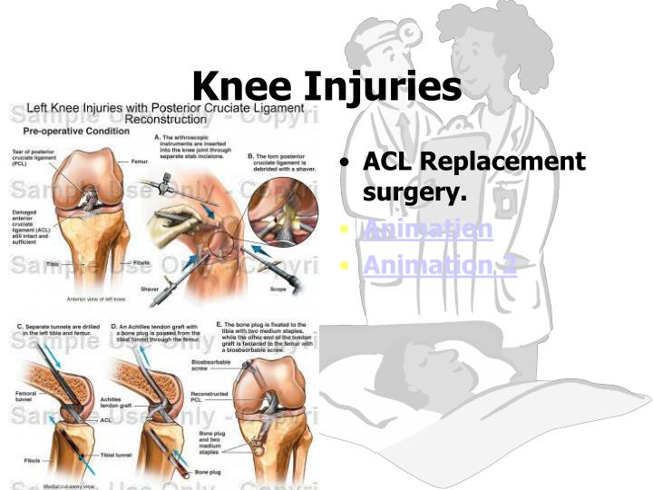 PPT - Knee Anatomy PowerPoint Presentation - ID:1227045