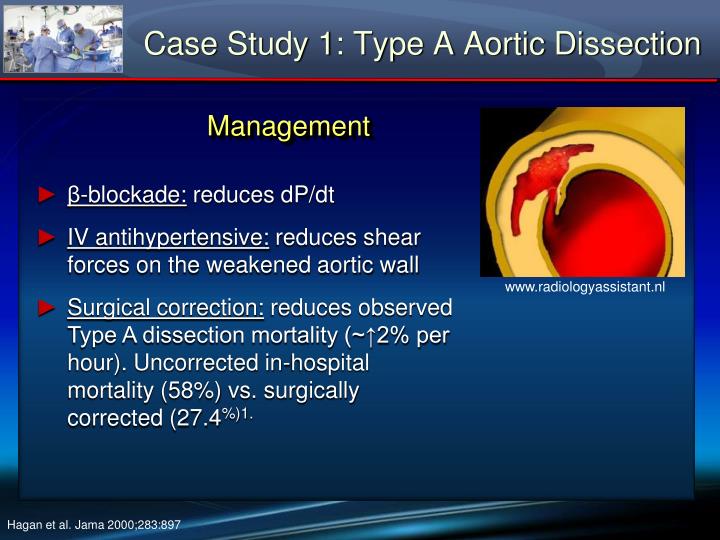 PPT - Case Studies in Acute Hypertension PowerPoint Presentation - ID ...