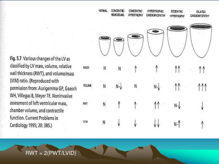 PPT - Echocardiographic Assessment of LV Systolic Function PowerPoint ...