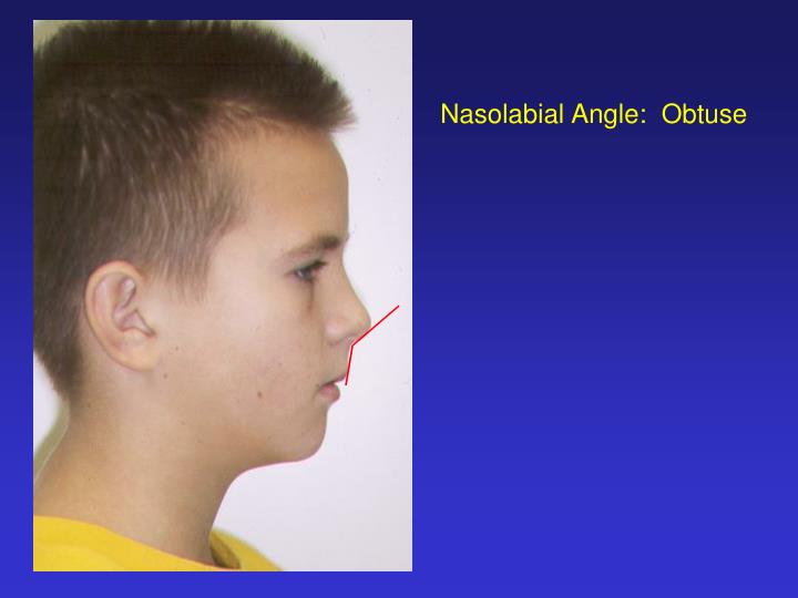 PPT - Orthodontic Case Analysis PowerPoint Presentation - ID:1231060