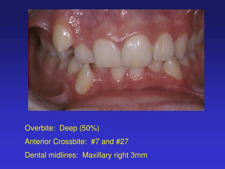 PPT - Orthodontic Case Analysis PowerPoint Presentation - ID:1231060