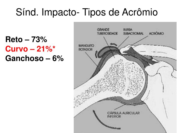 PPT - Lesões do Ombro PowerPoint Presentation - ID:1232124