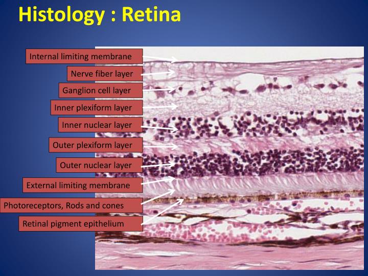 Histology Of Retina Labeled at Oliver Lake blog