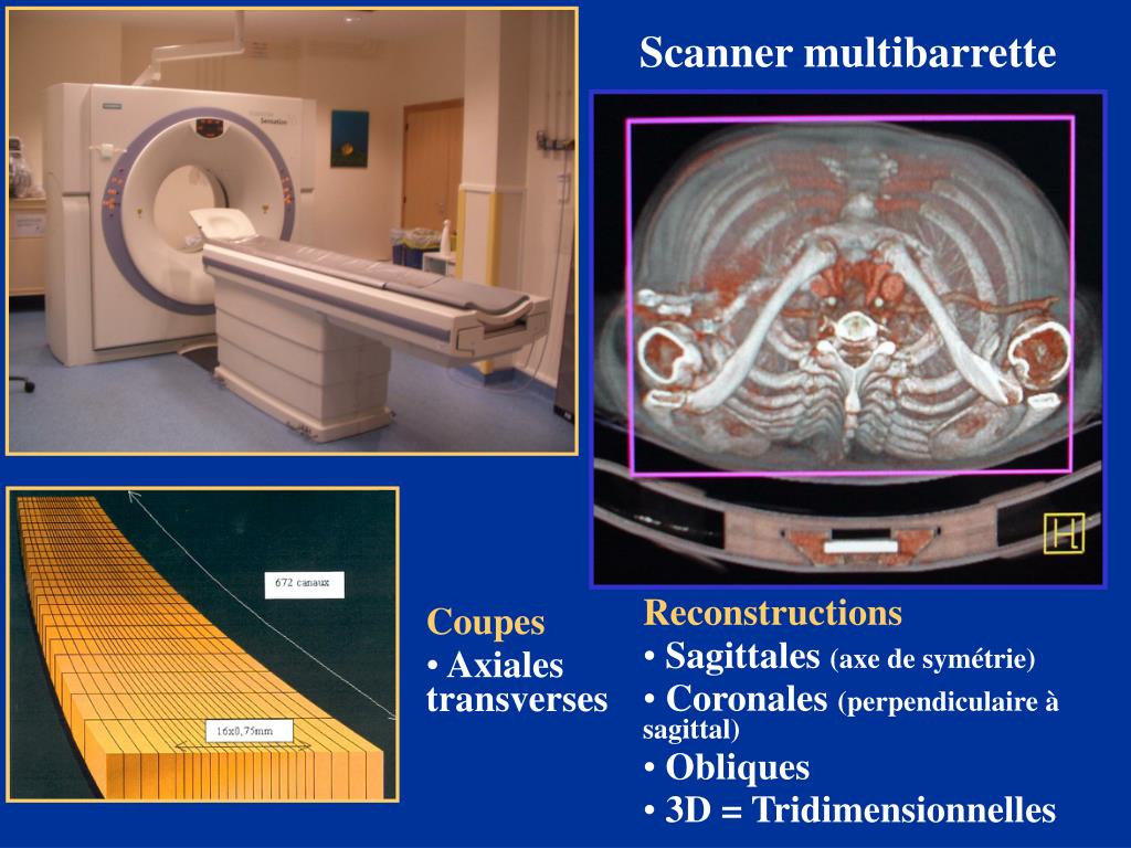 PPT - Scanner thoracique Anatomie du thorax en coupes PowerPoint ...